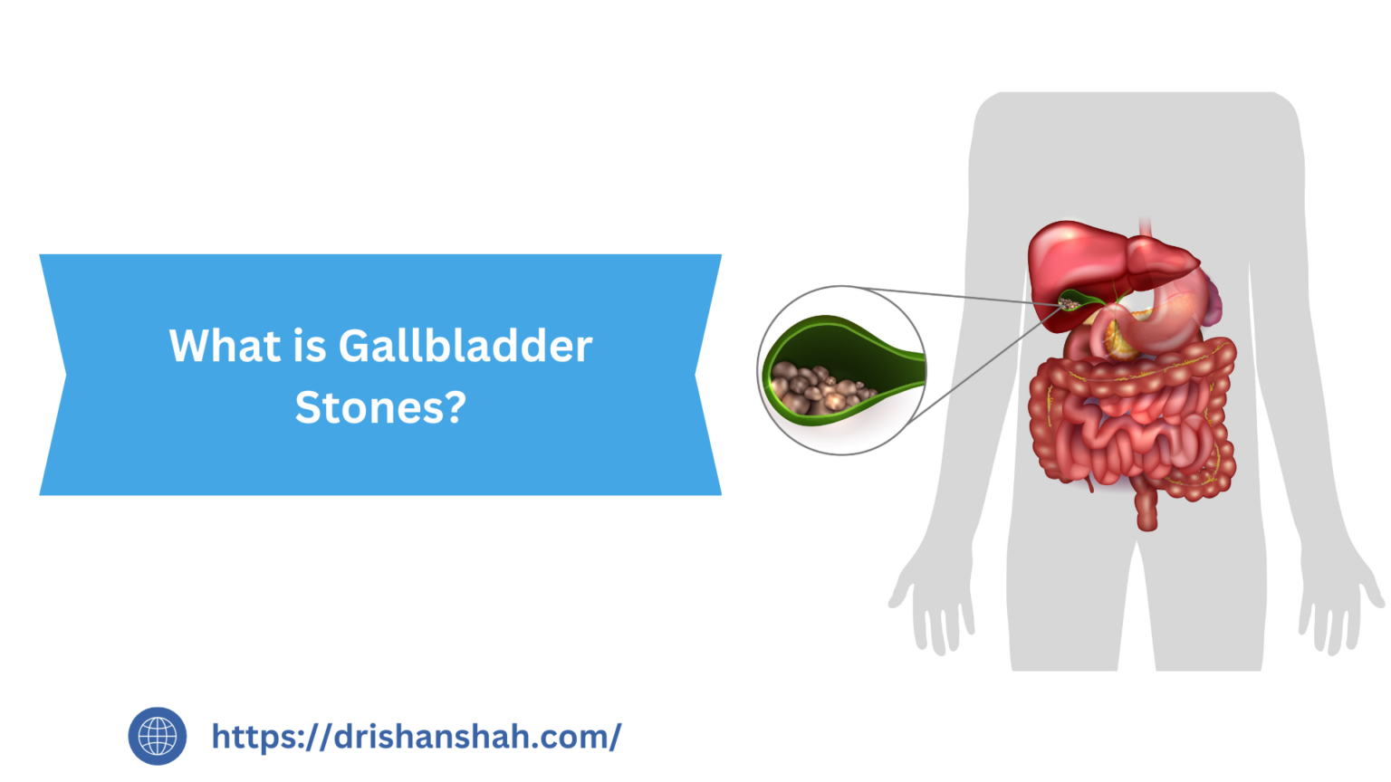 Gallbladder Stone Treatment: Pros and Cons 2024